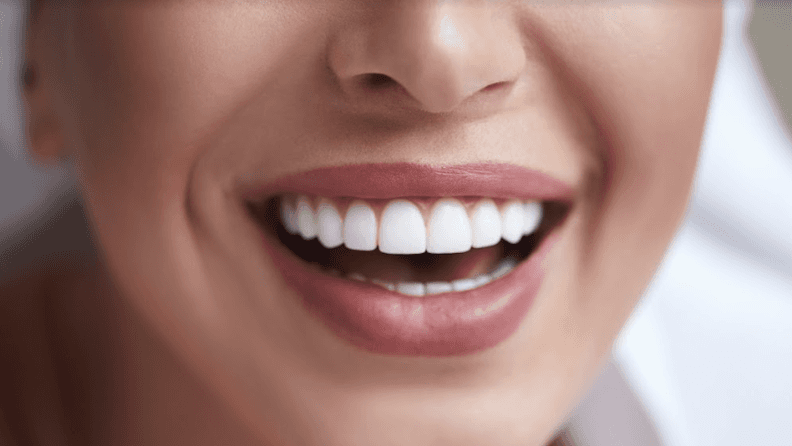 Dental Bonding: What Is Teeth Bonding & What to Expect | Roanoke VA